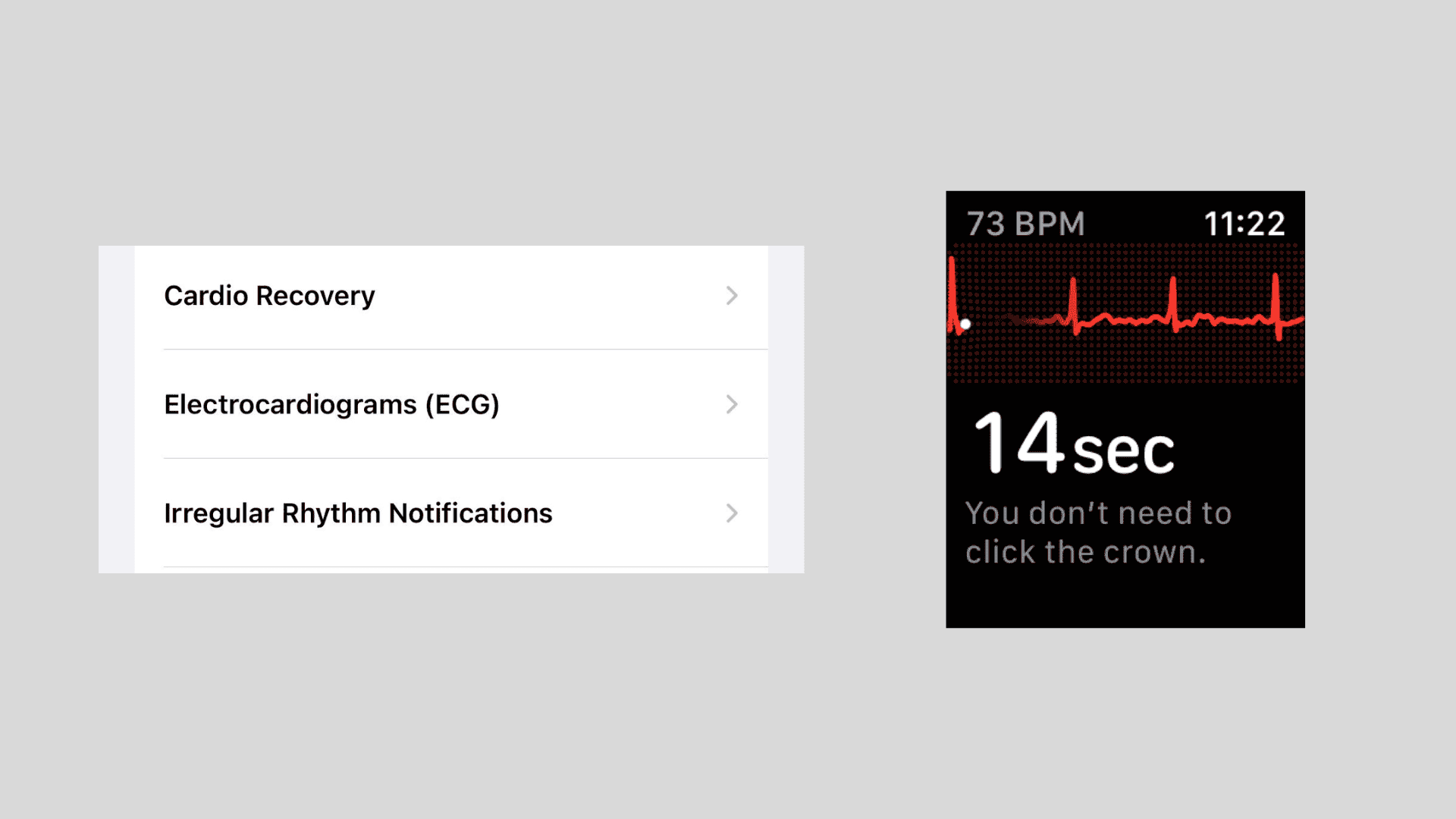 Use ECG on Apple Watch [Step-by-Step]