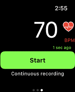 How to Show Heart Rate (Pulse) Directly on Apple Watch Face - The Mac ...