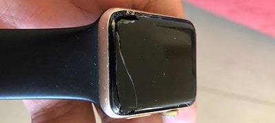 Here’s Why Your Apple Watch Is Leaving Burn Marks on Your Wrist - The ...