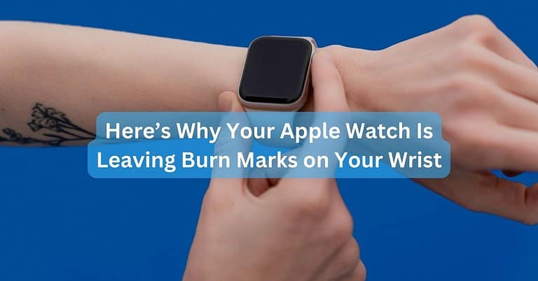 Here’s Why Your Apple Watch Is Leaving Burn Marks on Your Wrist - The ...