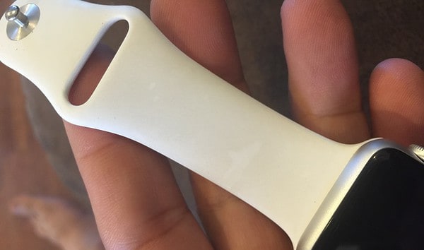 Here’s Why Your Apple Watch Is Leaving Burn Marks on Your Wrist - The ...