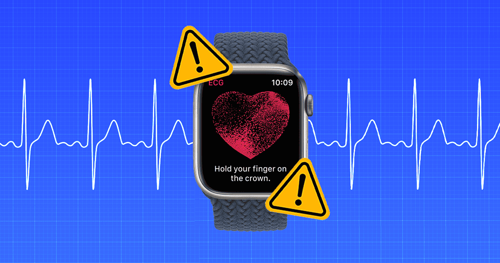 Apple Watch ECG Not Working? Here’s How To Fix It! - The Mac Observer