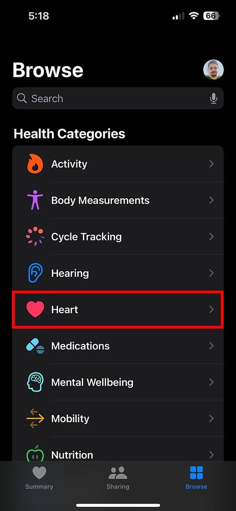 Apple Watch ECG Not Working? Here’s How To Fix It! - The Mac Observer