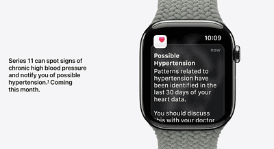 Apple Watch Series 11 vs 10: Should You Upgrade?