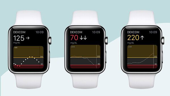 Apple Watch Long-Promised Blood Sugar Feature Is Missing, but Progress ...
